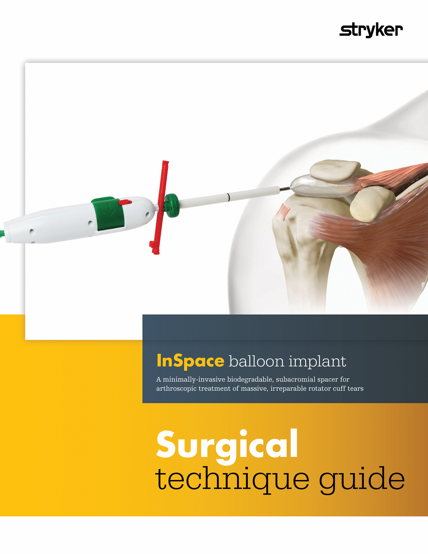 Stryker Engagement from Carissa Frausto